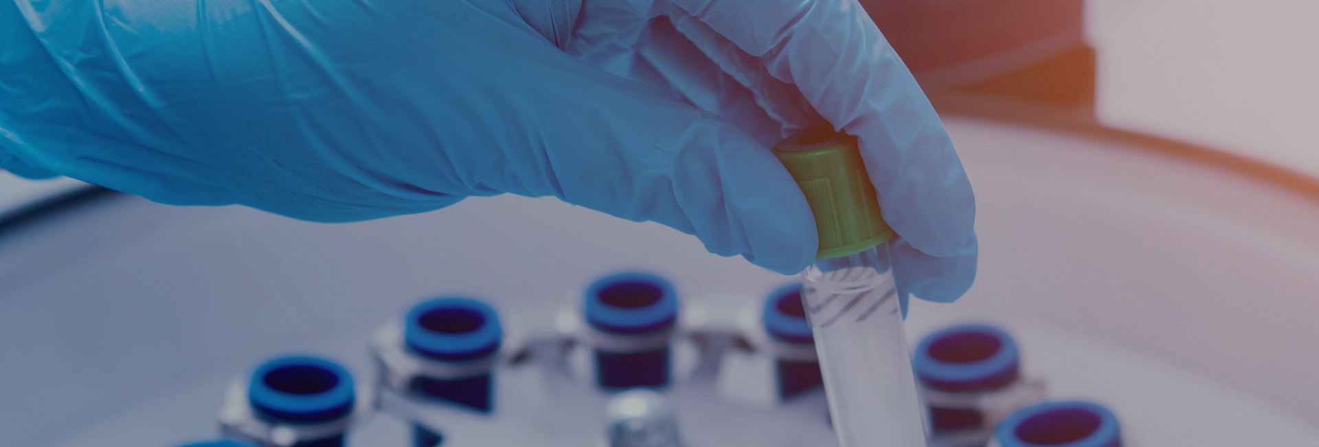 Biologic Drug Monitoring - Creative Diagnostics Reagents Biologic Drug Monitoring - Creative Diagnostics Reagents