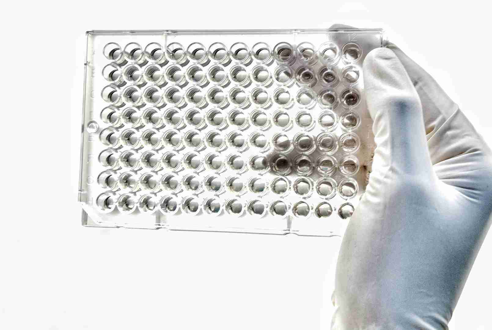 ADA Assay Development Service - Creative Diagnostics