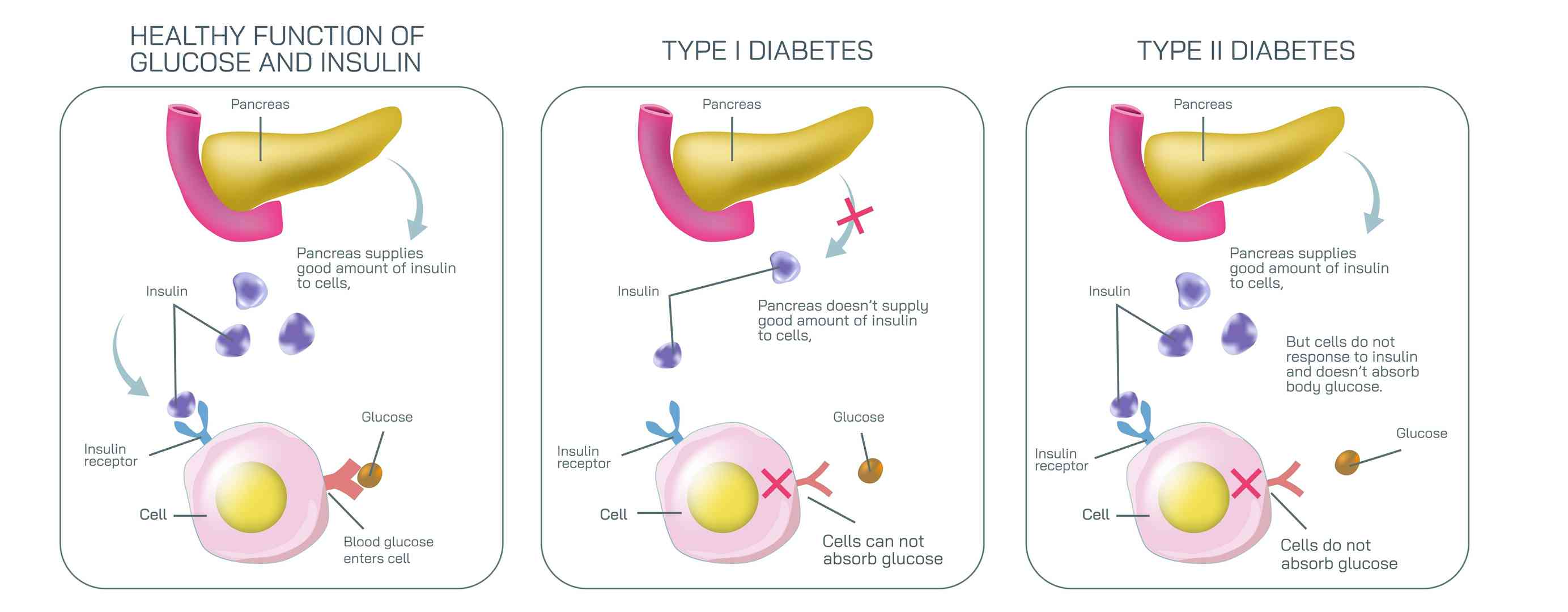 Insulin Antibody Detection ELISA kit: For Drug Monitoring - Creative ...