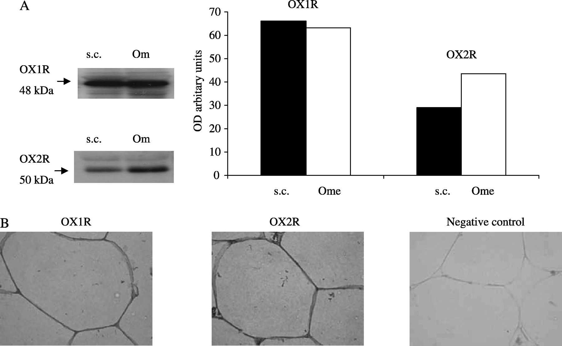 Orexin A - Creative Diagnostics