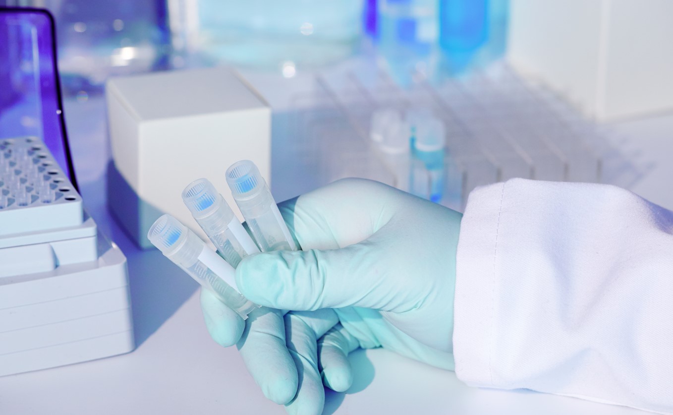 Overview of Factor X Protein - Creative Diagnostics