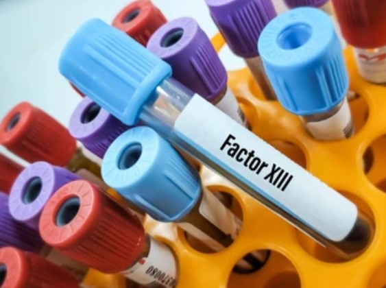 Overview of Factor XIII Protein - Creative Diagnostics